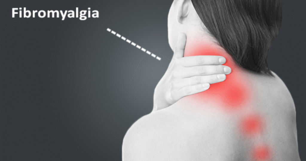 Can Fibromyalgia Cause High Labs? - Advance Study